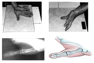 Roberts view : 네이버 블로그