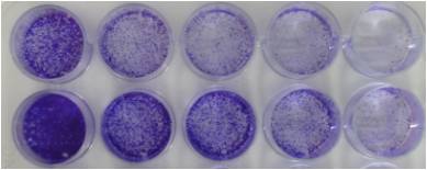 Clonogenic Assay of cells in vitro (=Colony formation assay) : 네이버 블로그