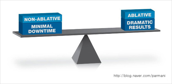 Sublative RF : Matrix RF : 네이버 블로그