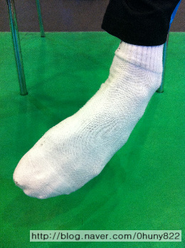 회외,회내의 Triplanar Movement (삼면 운동) : 네이버 블로그