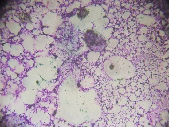 지방괴사/fat necrosis,panniculitis,steatitis/개,강아지,애견세포학/신천,삼전,잠실동물병원,송파구 ...