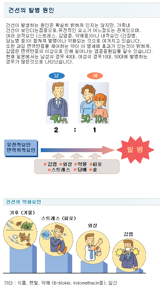 건선의 원인2 네이버 블로그