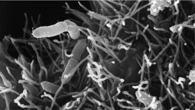 살 파먹는 세균 감염경로(Aeromonas hydrophila - 아에로모나스 하이드로필라) : 네이버 블로그
