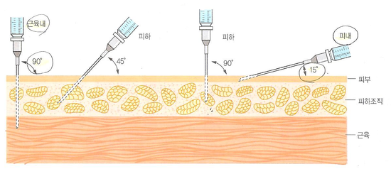 투약간호(비경구투여)-피내,피하,근육,정맥(ID,SC,IM,IV)intradermal injection, subcutaneous ...