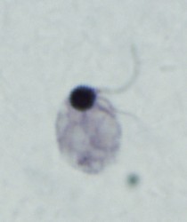 장후진편모충(Retortamonas intestinalis) : 네이버 블로그