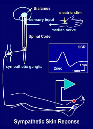 사건관련전위 - SSR, Sympathetic Skin Response : 네이버 블로그