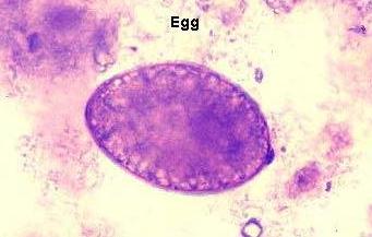 광절열두조충(Diphyllobothrium latum) Broad fish tapeworm : 네이버 블로그