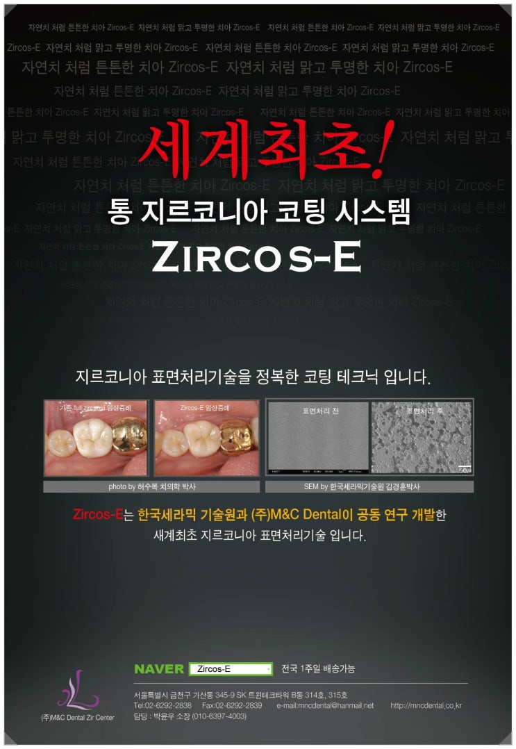 세계최초 통 지르코니아 코팅 시스템 지르코스이(Zircos-E) : 네이버 블로그