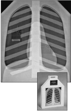 Chest Phantom,Duke phantom,DR 팬텀,흉부팬텀,chest팬텀,Digital X-Ray Phantom,QC ...