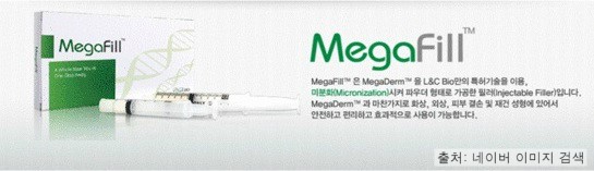 음경확대용 주입 재료- 메가필(MegaFill)을 소개 해드립니다 : 네이버 블로그