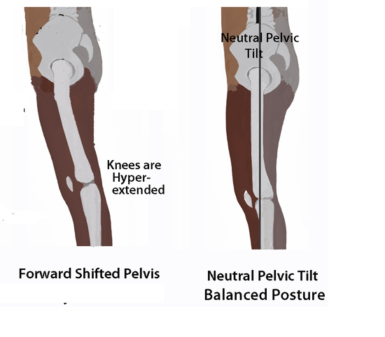 pevic girdle pattern② pelvic shift : 네이버 블로그