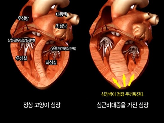 고양이 심근비대증 - HCM (Feline Hypertrophic Cardiomyopathy) : 네이버 블로그