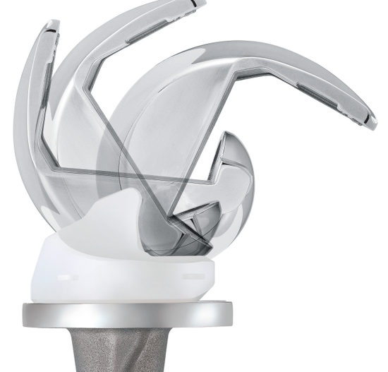 무릎 인공관절 고도 굴곡 Depuy PFC sigma RPF : 네이버 블로그