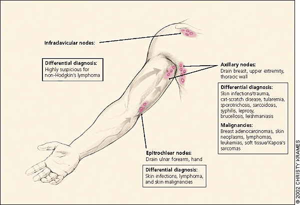 epitrochlear muscles (활차상주근) : 네이버 블로그