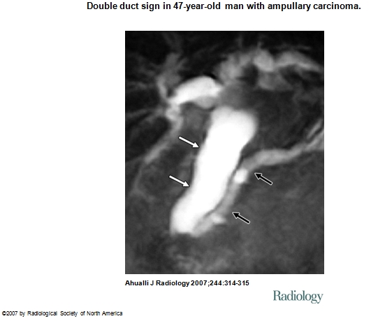 double duct sign : 네이버 블로그