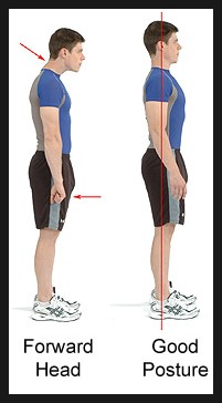 체형교정 Flat Back이란?? : 네이버 블로그