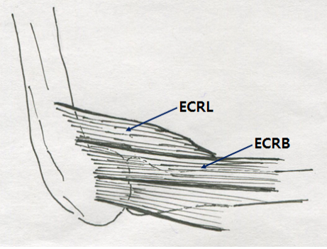 35일차. ECRL(Extensor carpi radialis longus, 장요측수근신근)-긴노쪽손목폄근 : 네이버 블로그