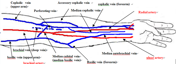 Arteriovenous access (AVF and AVG) : 네이버 블로그