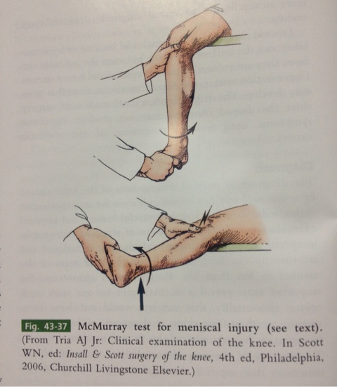 McMurray & Apley test : 네이버 블로그
