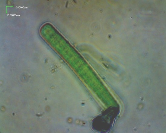 cyanobacteria .Oscillatoriales/시아노박테리아-POLYVAR Microscope. : 네이버 블로그