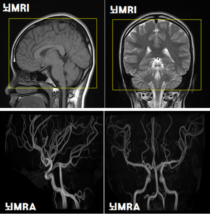 mri 와 mra : 네이버 블로그