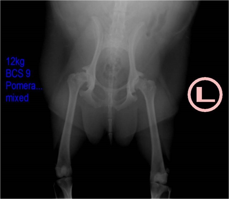 Hip joint DJD (Osteophytes) : 네이버 블로그