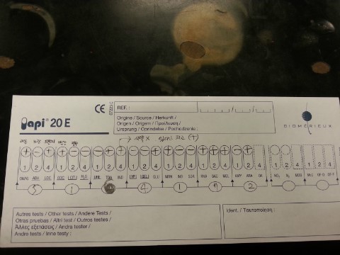 api kit 20E 실험 사진자료 : 네이버 블로그