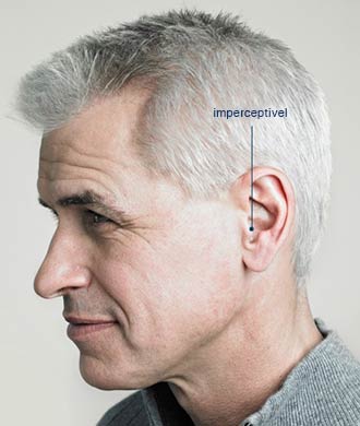 유니트론, 마이크로 CIC(Micro CIC), 초소형고막형 보청기, 마이크로 CIC(Micro CIC), IIC보청기 ...