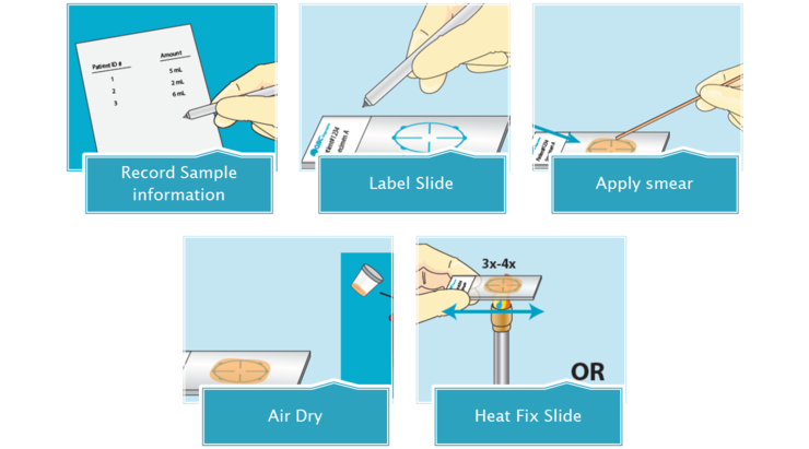 QBC F.A.S.T SureFocus Slide 준비 및 검경 방법 : 네이버 블로그