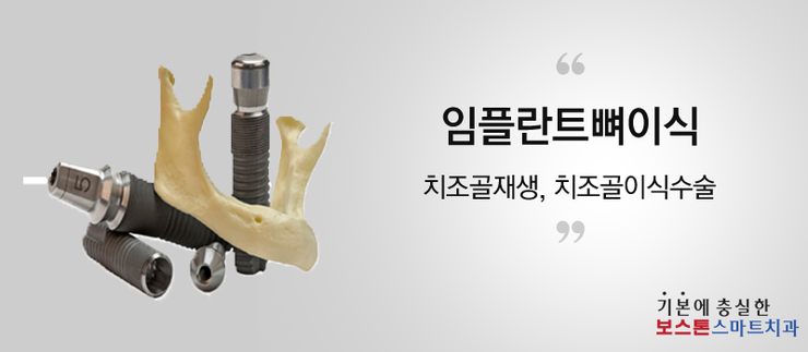 건대임플란트뼈이식 치조골재생 치조골이식수술 네이버 블로그