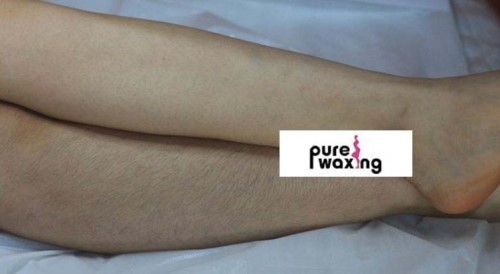 신도림퓨어왁싱여자 다리 왁싱시술사진다리 인그로운헤어신도림왁싱 잘하는곳신도림 브라질리언 왁싱샵비키니왁싱 전문구로왁싱