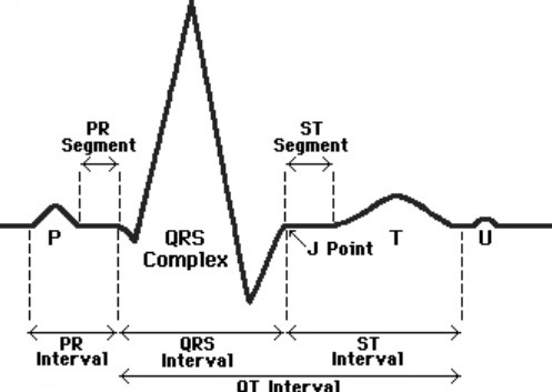 [ECG basic] normal ECG characteristics and measurement abnormalities ...