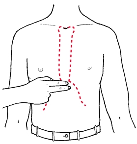 Gastritis vs Xiphoidalgia : 네이버 블로그