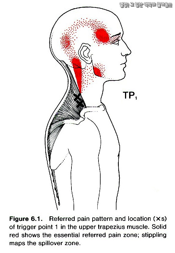 트리거포인트(Trigger Point) - 두경부 : 네이버 블로그