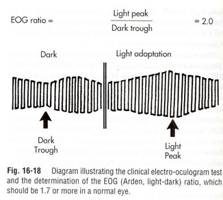 Electrooculogram, 안전위도검사 : 네이버 블로그