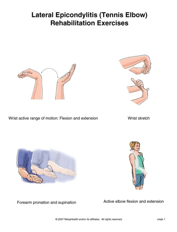 외측상과염(테니스 엘보) 재활운동 - Lateral Epicondylitis (Tennis Elbow ...