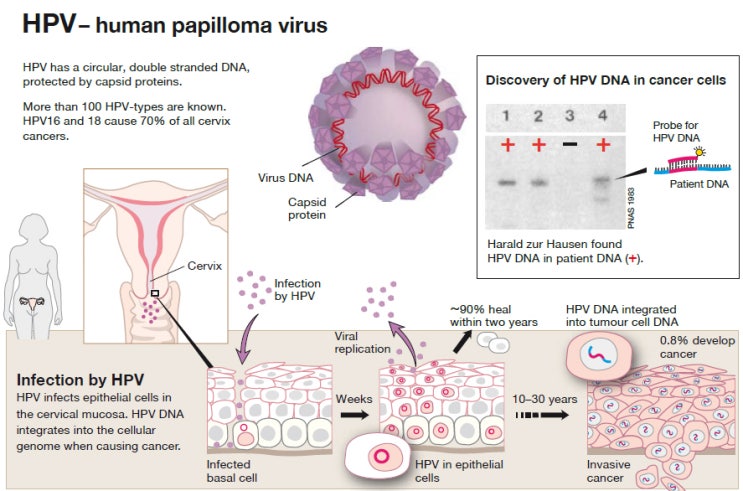 인유두종바이러스 분자진단(HPV DNA) -자궁경부암 : 네이버 블로그