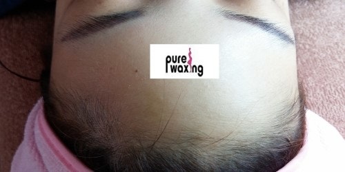 신도림퓨어왁싱여자 이마왁싱 시술사진신도림왁싱 잘하는곳신도림 브라질리언 왁싱샵비키니왁싱 전문구로왁싱여의도왁싱대림왁싱