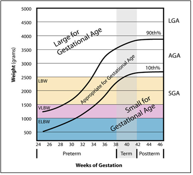 미숙아의 분류(LBW, VLBW, ELBW, IUGR, LGA, SGA) : 네이버 블로그