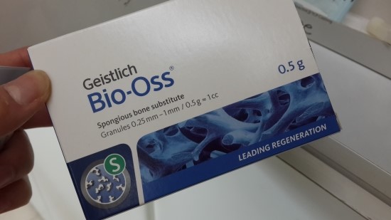 Bio-Oss® : 네이버 블로그
