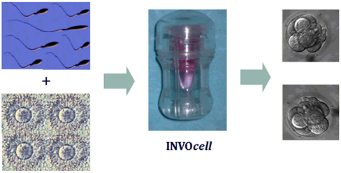 시험관 아기 시술 배아의 성장을 엄마의 질에서? : 네이버 블로그
