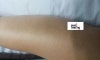 신도림퓨어왁싱여자팔왁싱시술사진팔 인그로운헤어신도림왁싱 잘하는곳신도림 브라질리언 왁싱샵비키니왁싱 전문구로왁싱여의도왁싱