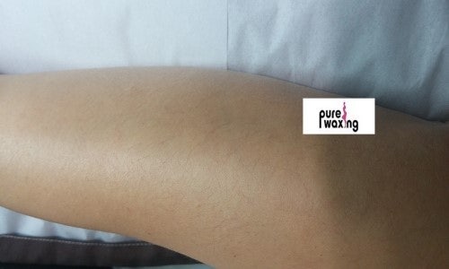 신도림퓨어왁싱여자팔왁싱시술사진팔 인그로운헤어신도림왁싱 잘하는곳신도림 브라질리언 왁싱샵비키니왁싱 전문구로왁싱여의도왁싱