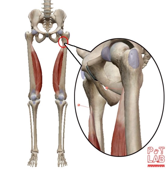 양재동피티 피티랩 하체근육 내측광근vmovastus Medialis Oblique 기능해부학 및 무릎통증 네이버 블로그