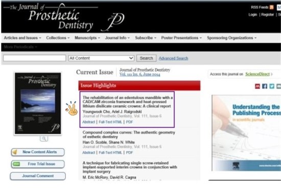 조영욱 원장님의 논문이 미국보철전문저널(JPD) 6월호의 Issue Highlights에 선정되었습니다 : 네이버 블로그