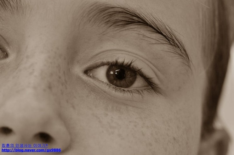 다크서클 생기는이유와 없애는법~! : 네이버 블로그