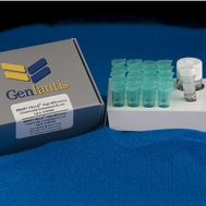 Competent Cell도 골라서 쓰세요! : 네이버 블로그