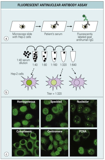 Antinuclear antibodies (ANA) : 네이버 블로그