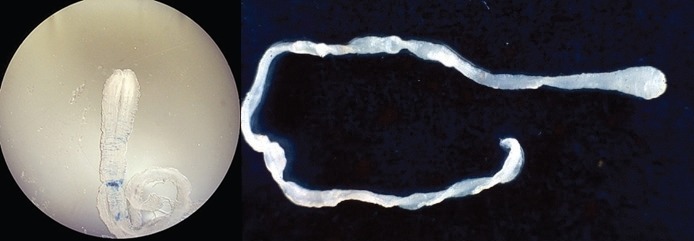 20. '몸 속에서 꿈틀' 기생충 스파르가눔을 아시나요? : 네이버 블로그