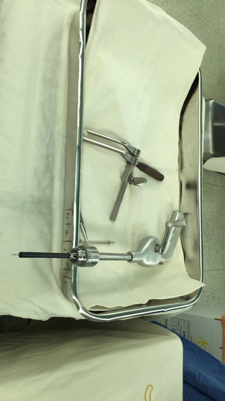 ACDF instrument (pf양) : 네이버 블로그